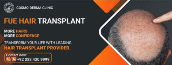 Laser Hair Transplant Lahore Pakistan No Stitches No Incision